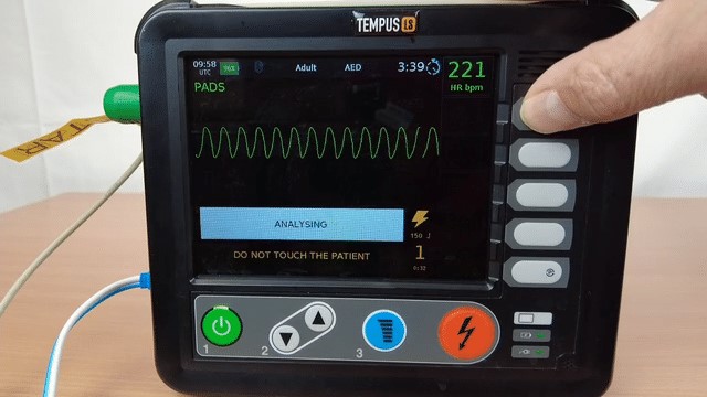 Tempus Defibrillator | NISTAR